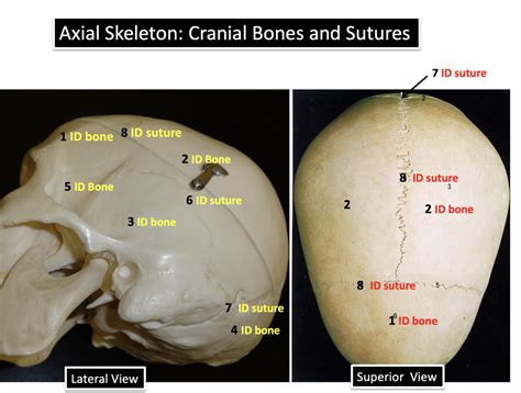 Sutures Orbit And Cranial Bones 9 Items Exclude Orbit And Ethmoid