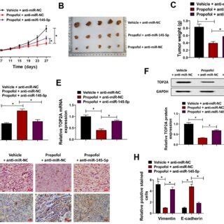 Propofol Attenuates Tumor Growth Via Regulation Of MiR 145 5p TOP2A In