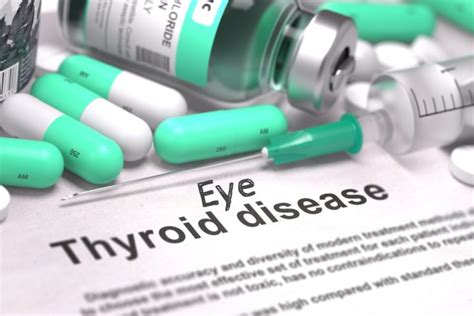 Tepezza For Thyroid Eye Disease Suzy Cohen Suggests Ways To Heal