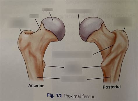 Proximal Femur Diagram Quizlet