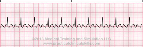 Ecg Practice Drill