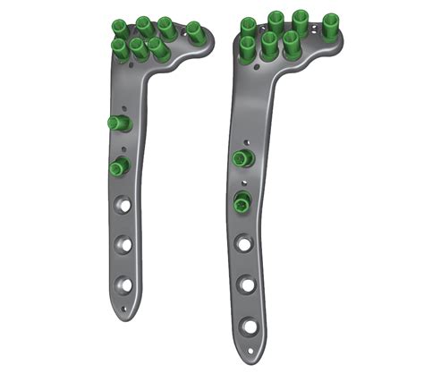 Alps® Proximal Tibia Plating System