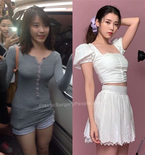 Korean Singer Iu Before And After 2022