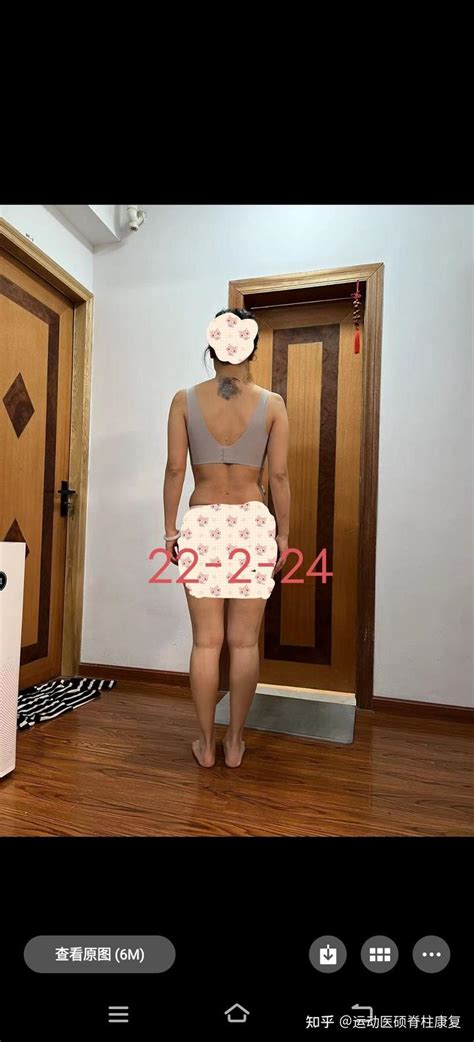 如何判断腰突颈突脊柱康复训练是否正确，其实很简单。但凡产生疼痛的的训练都是错误的，不会看到好转迹象。正确康复训练不会产生疼痛，会以周为时间单位