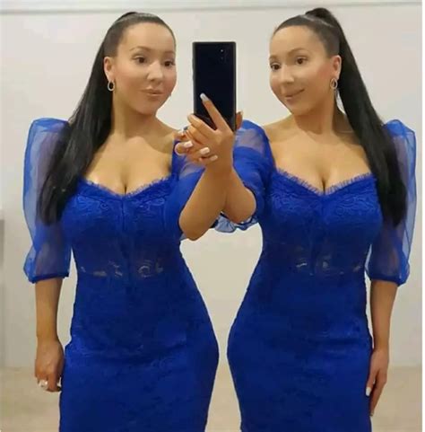 See Before And After Photos Of Anna And Lucy Who Did Plastic Surgery To