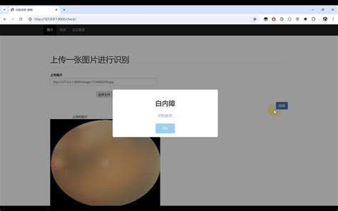 【眼疾病识别】图像识别深度学习技术人工智能卷积神经网络算法计算机课设pythontensorflow 阿里云开发者社区