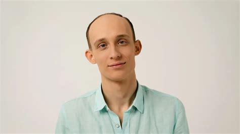 Is Balding Genetic Unraveling The Truth Behind The Inherited Phenomenon