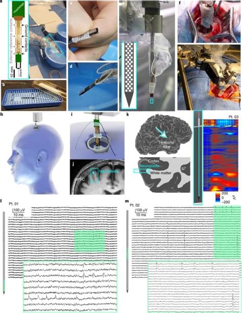 Large Scale Neural Recordings With Single Neuron Resolution Using
