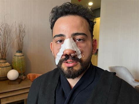 Restoran Çalışanları Darp Edilen Adam Burnunu Kırdırdı Meltem TV