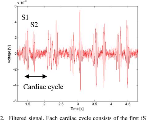 Figure 1 From Measurement Of Heart Sounds With Emfi Transducer