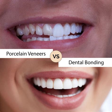 What Small Cavities Look Like And When To Seek Care