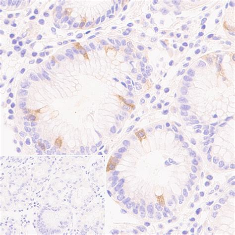 Anti Rrm2 Antibody Epr11820 Ab172476 Abcam