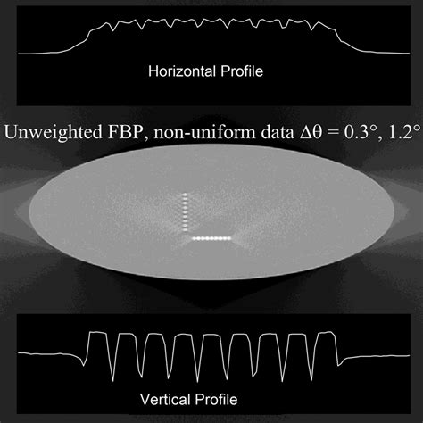 Fbp Reconstruction Of A Simulated Resolution Phantom Using Non Uniform