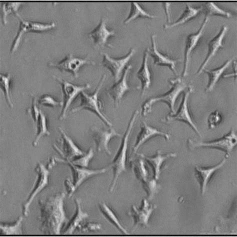 Image Of Amniotic Fluid Cells Grown In Amniomax Media After 15 Days Download Scientific Diagram