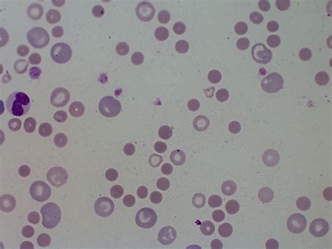 Imagespherocytes Dog Msd Veterinary Manual