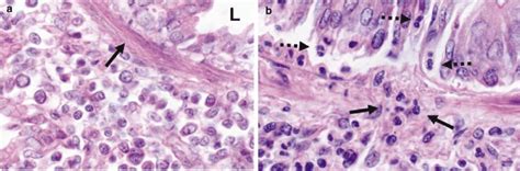 Relative Segregation Of Mononuclear Cells And Polymorphonuclear Download Scientific Diagram Relative Segregation Of Mononuclear Cells And Polymorphonuclear Download Scientific Diagram