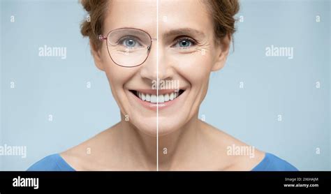 Laser Vision Correction Woman Face With And Without Glasses On Blue Background Showing Vision