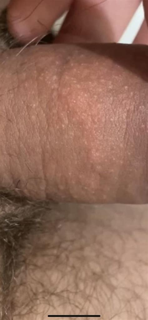 Need Help Reading Std Test Results R Std