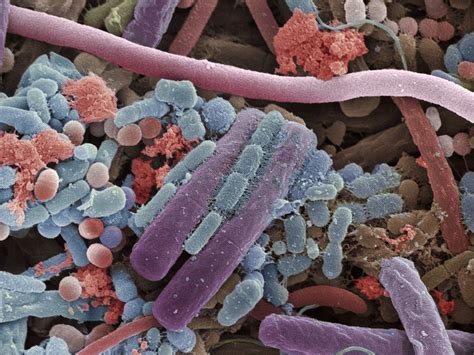 Каква е разликата между вирусните и бактериалните инфекции Без Кафе