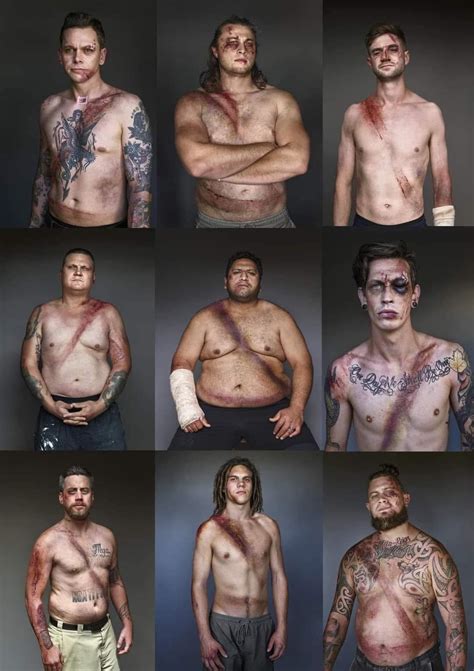 My Энэ бол авто ослын дараа амьд үлдсэн хүмүүсийн бодит зурагнууд Цээжин дээрх улаан няцууд