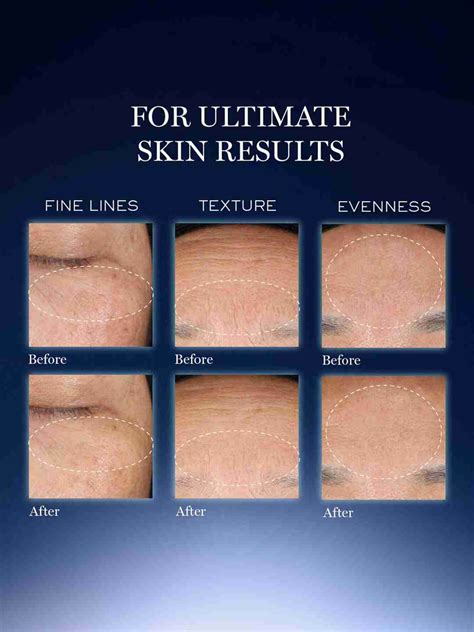 Genifique Ultimate Youth Activating Serum With Beta Glucan For Skin
