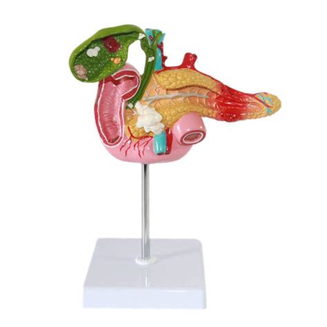 Xiezi Human Anatomical Model Pancreas Duodenum Gallbladder Modelvessels