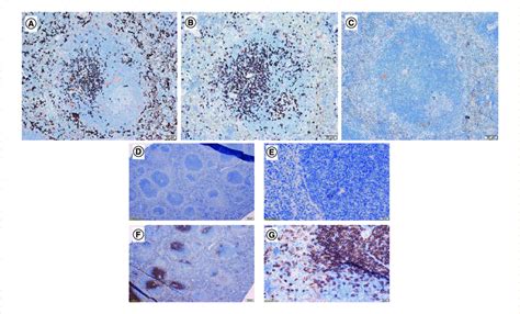 Spleen Cell Sections Treated Using Instant Pot Antigen Retrieval Method