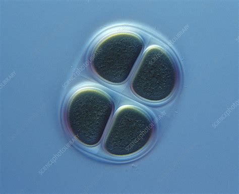 Chroococcus Turgidus Cyanobacteria Stock Image C005 8238 Science