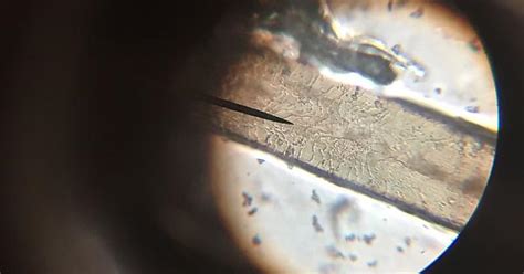 Forensics Album On Imgur