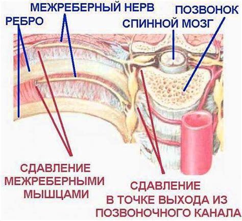 Міалгія: симптоми і лікування - Фарман