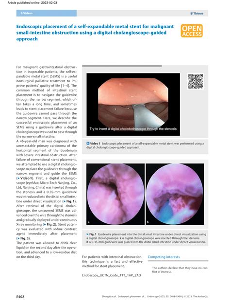 Pdf Endoscopic Placement Of A Self Expandable Metal Stent For