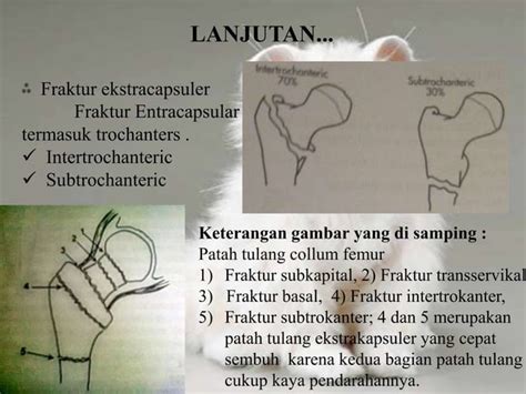 Ppt Fraktur Collum Femur Pptx