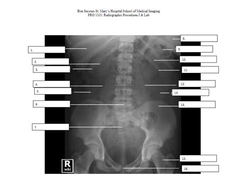 Supine Kub Diagram Quizlet