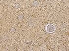 Isospora Spp Wikivet English