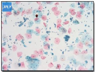 灰度位数12bit与16bit在图像分辨上的区别