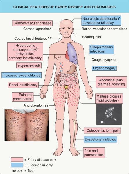 Other Genodermatoses Plastic Surgery Key