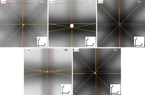 Figure 3 From A Procedure To Determine The Radiation Isocenter Size In