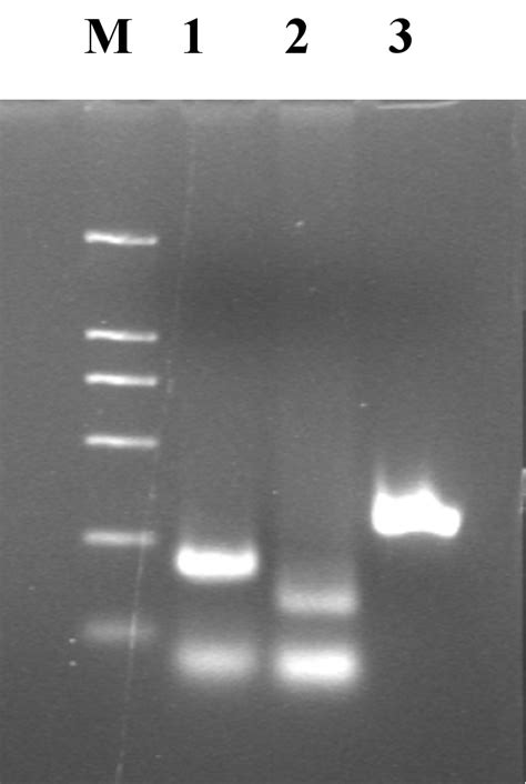 Mboii Restriction Patterns Of The Pcr Amplified Rpsl Gene Lane 1 Pcr