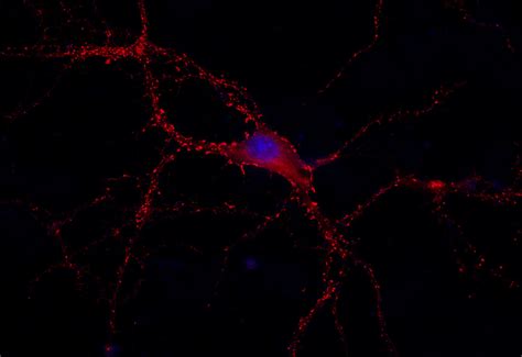 Synaptic Systems Vglut1