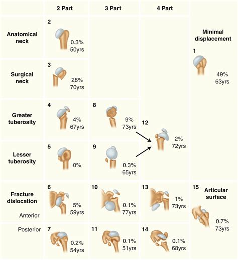 Fig 10 1 Neers Classification With Prevalence And