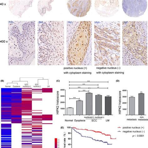 Homeodomain‐interacting Protein Kinase 2 Hipk2 Staining Expression