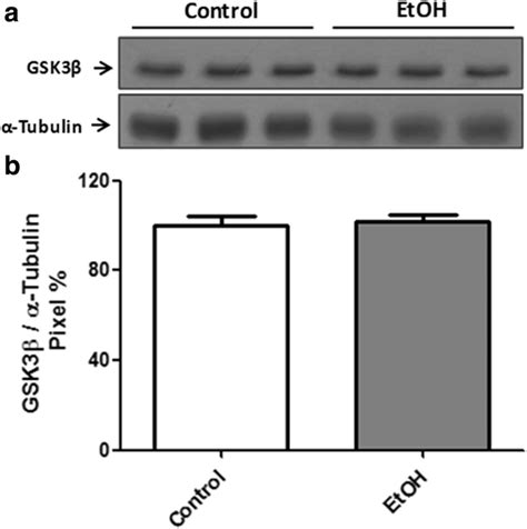 Western Blot Analysis Of Gsk3β In The Dh The Student T Test Revealed