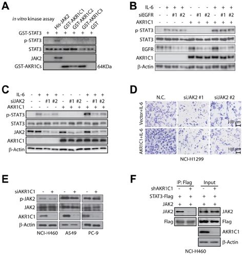 Akr1c1 Facilitates The Interaction Of Stat3 And Jak2 In Nsclc A