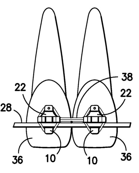 Sketch To Bracket Orthodontic Products