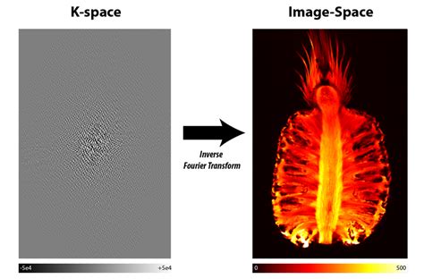 4 mr image reconstruction from k space plot of the k space of a t 1