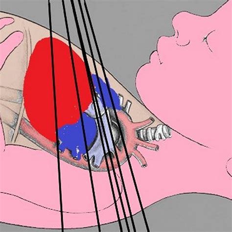 Fetal Echocardiography Sonoshare