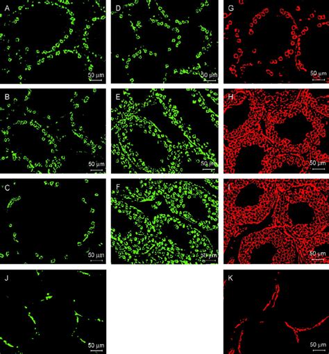 Immunofluorescence Of Testis Of Experimental Cryptorchid Mice A Download Scientific Diagram