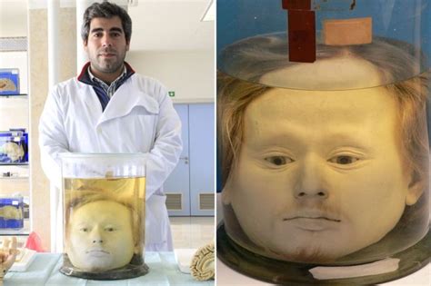 How Scientists Preserved The Severed Head Of One Of Europes Worst