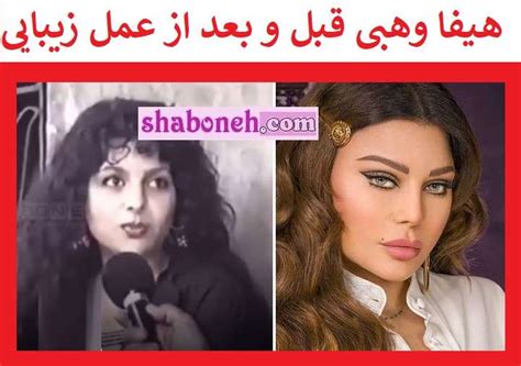 هیفا وهبی قبل عمل زیبایی تصاویر و عکس های قدیمی مجله شبونه