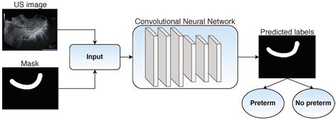 machine learning methods for preterm birth prediction a review